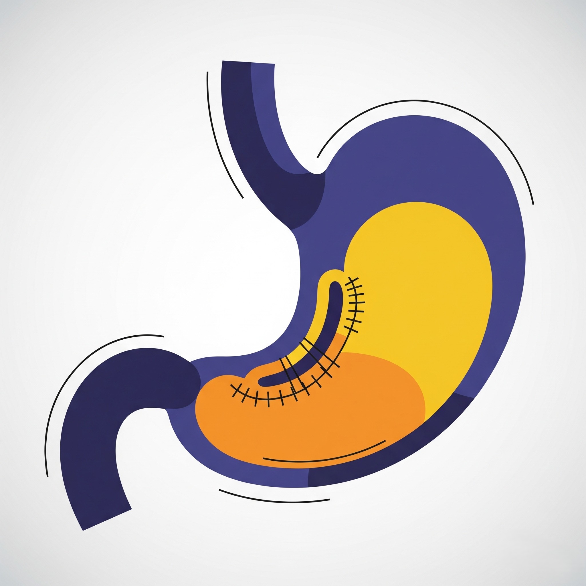 Bariatric Surgery - LSDC Healthcare